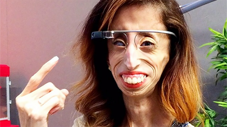 The "Ugliest Woman In The World" Never Gave Up, Now She's Inspiring ...