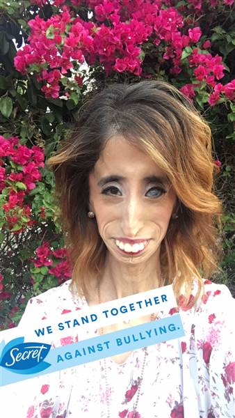 10 Years After Being Mocked As "World's Ugliest Woman," Lizzie ...