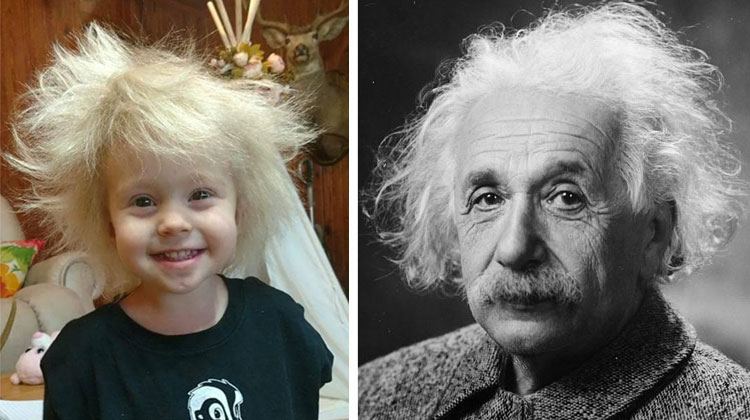 Mom Freaks When 2-Yr-Old's Hair Turns White, But Doctors Reveal She ...