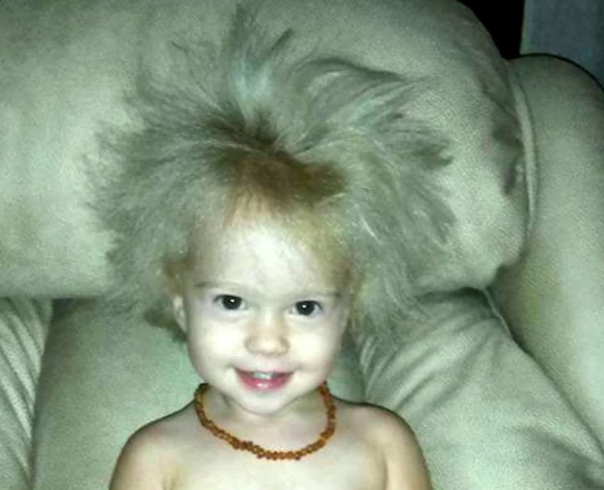 Mom Freaks When 2-Yr-Old's Hair Turns White, But Doctors Reveal She ...