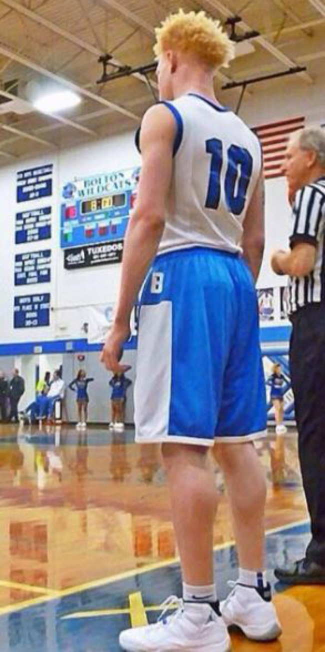 Albino TCU Player Gives Advice On Bullying– InspireMore