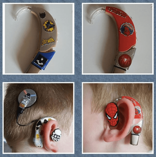 Mom Designs Hearing Aid Decorations For Deaf Children. -InspireMore