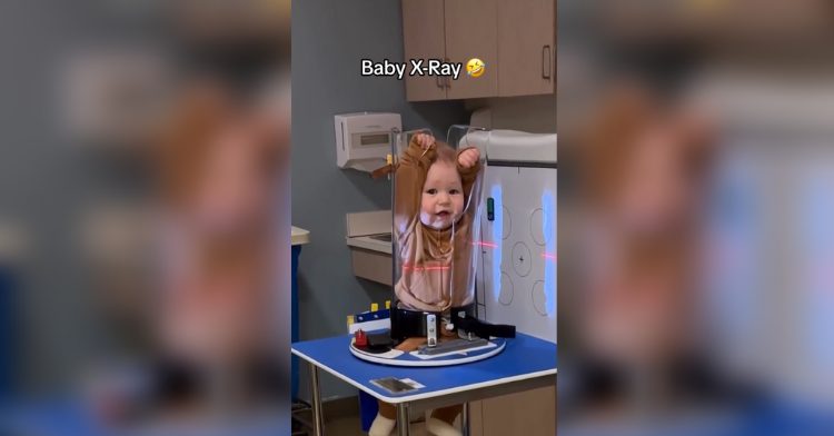 Adorably Optimistic: Baby Smiles With Joy Despite Outrageous X-Ray ...